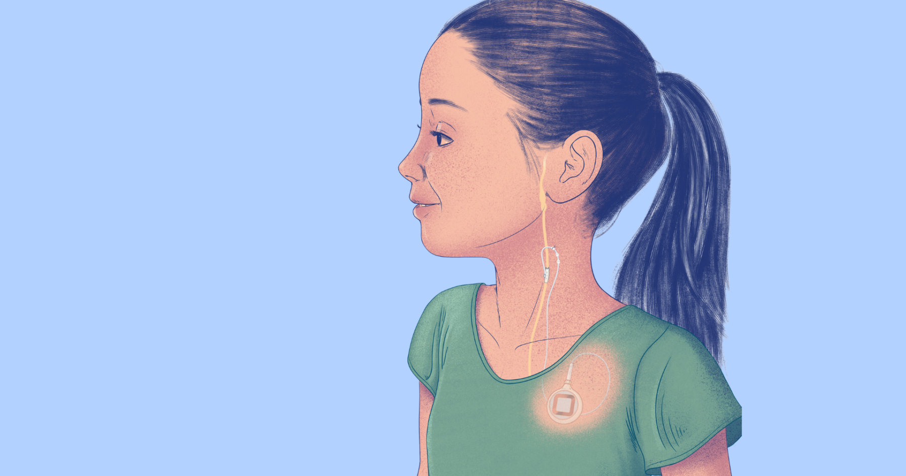 Synergia Medical: From perseverance to successful results! – MecaTech